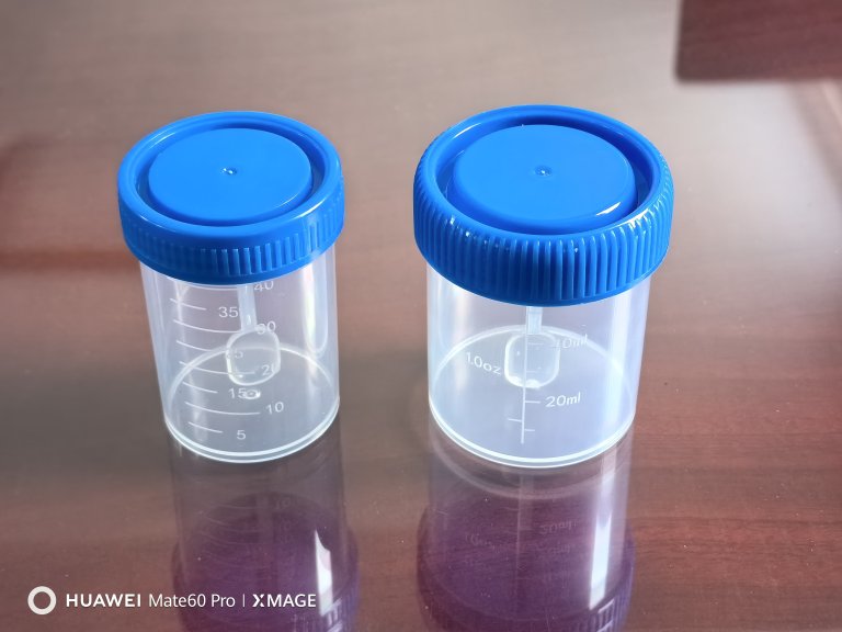 Fecal Specimen Cup-Jiangsu Kehua Medical Instrument Technology Co., Ltd.